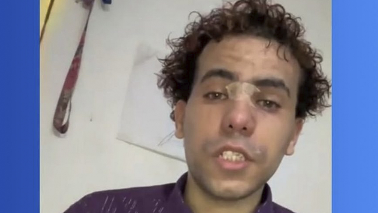 Fiscalía inicia averiguación por agresiones contra joven autista